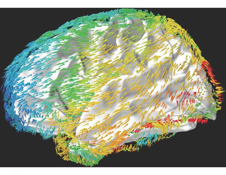Waves Move Across the Human Brain to Support Memory – Prof.Dr Lakshman ...